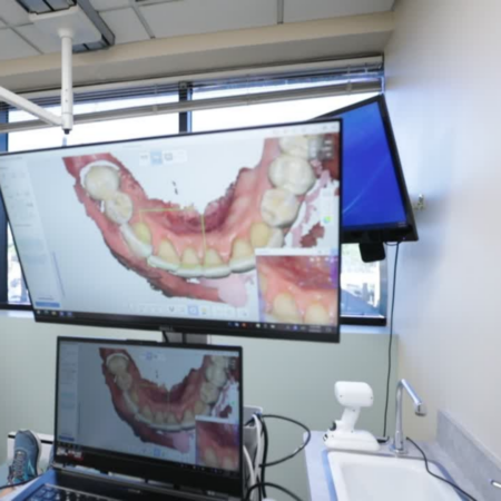 X-Nav: A Revolutionary Full Arch Approach - Alfred Penhaskashi, DDS